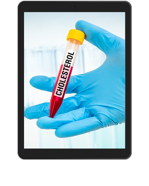 Your Perfect Cholesterol Without Statin Drugs Video Webinar – The Drs ...